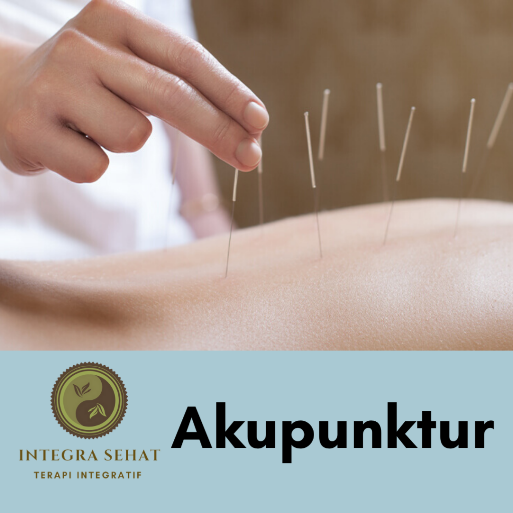 Akupunktur – Jamu Heritage